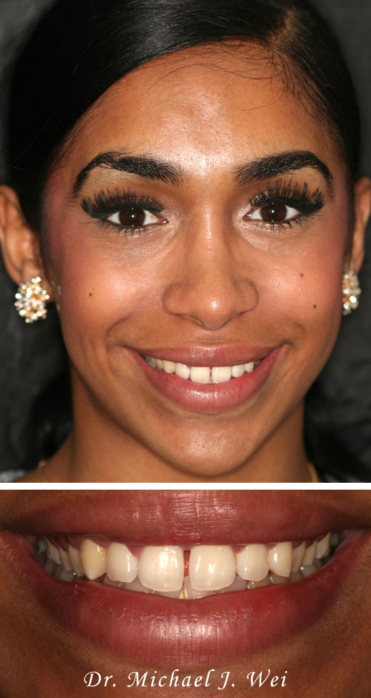 jaemy-b-bef540x1015sig4 - Michael J. Wei DDS PC