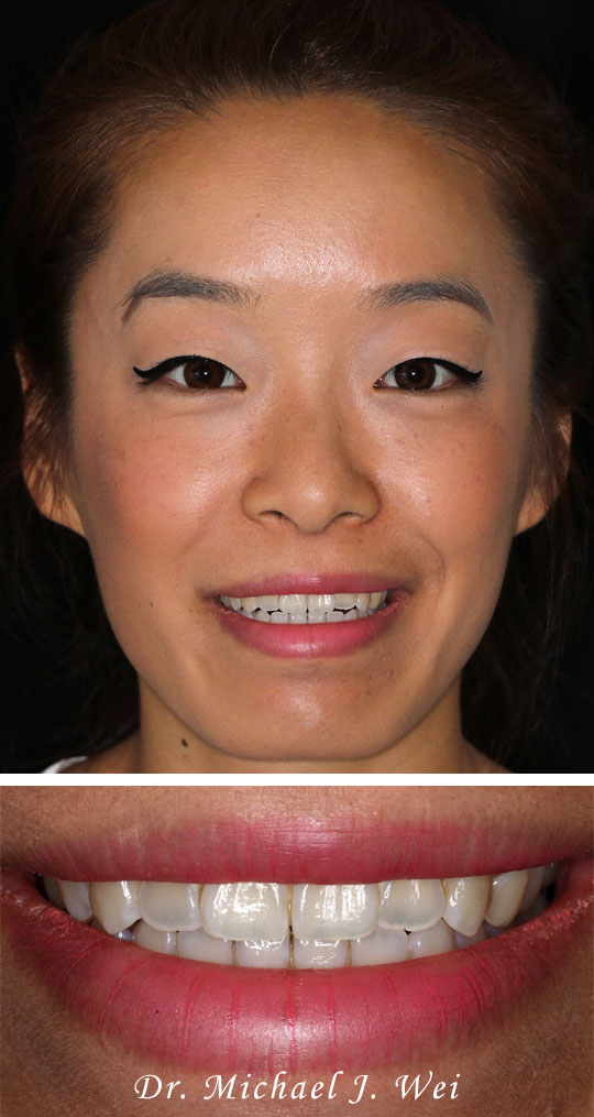 sharon-z-bef540x1015sig - Michael J. Wei DDS PC